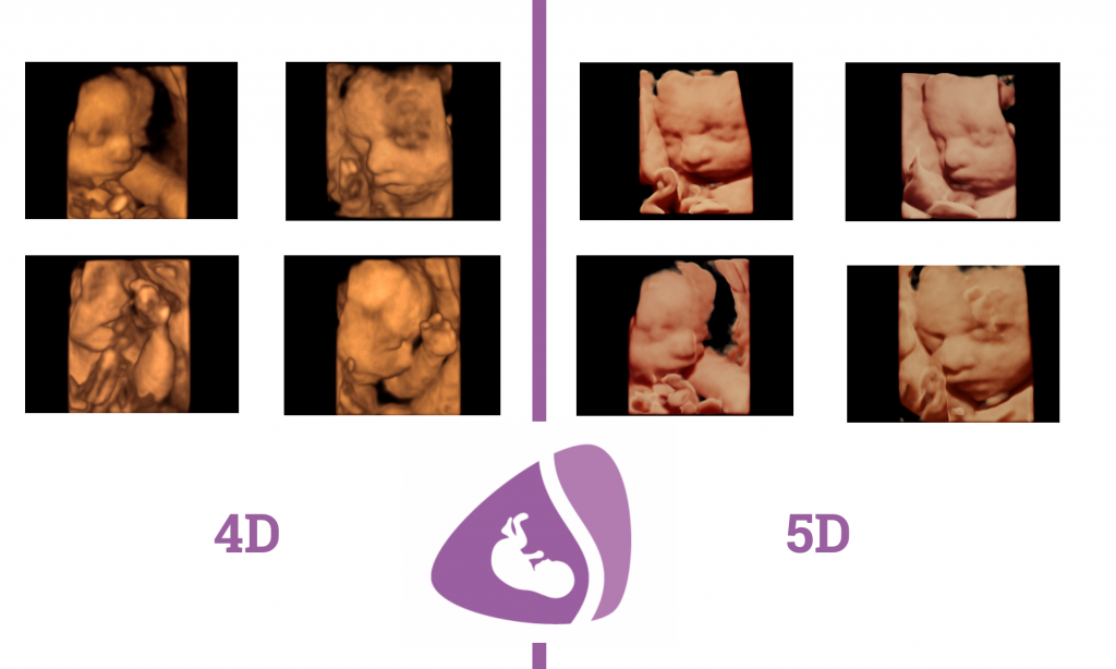 Ultrasonidos – Dr. Rafael Calderon